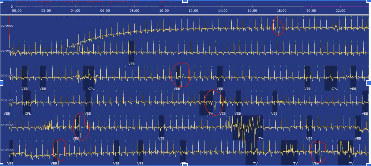 Pose de holter vétérinaire chien et chat en CH à Versailles